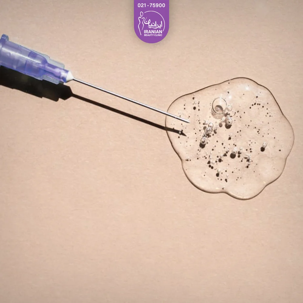 Filler Injections for Volume – Cost, Benefits, Side Effects, and Longevity