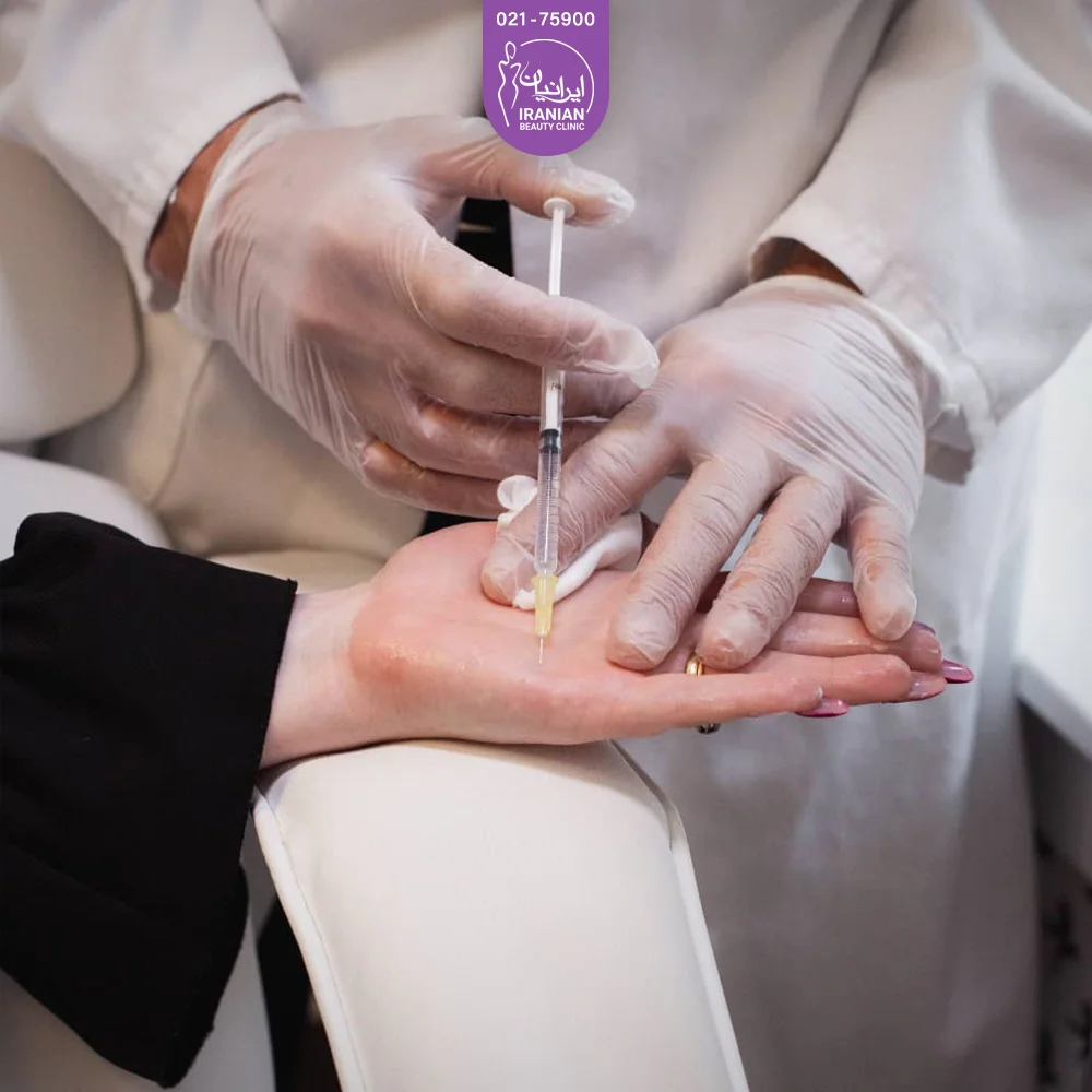 Botox Injection in the Palm of the Hand + Cost and Side Effects