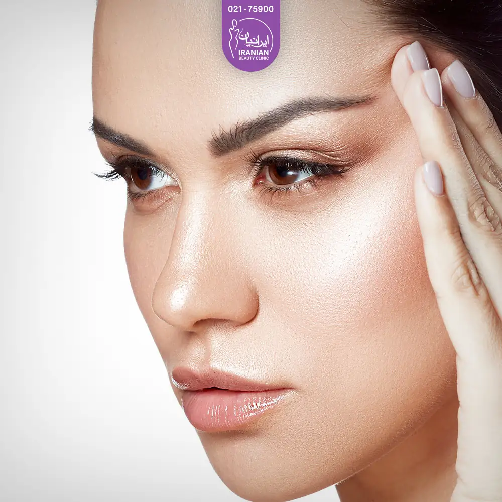 Temple Lift with Thread | Non-Surgical Facelift for Youthful Contours